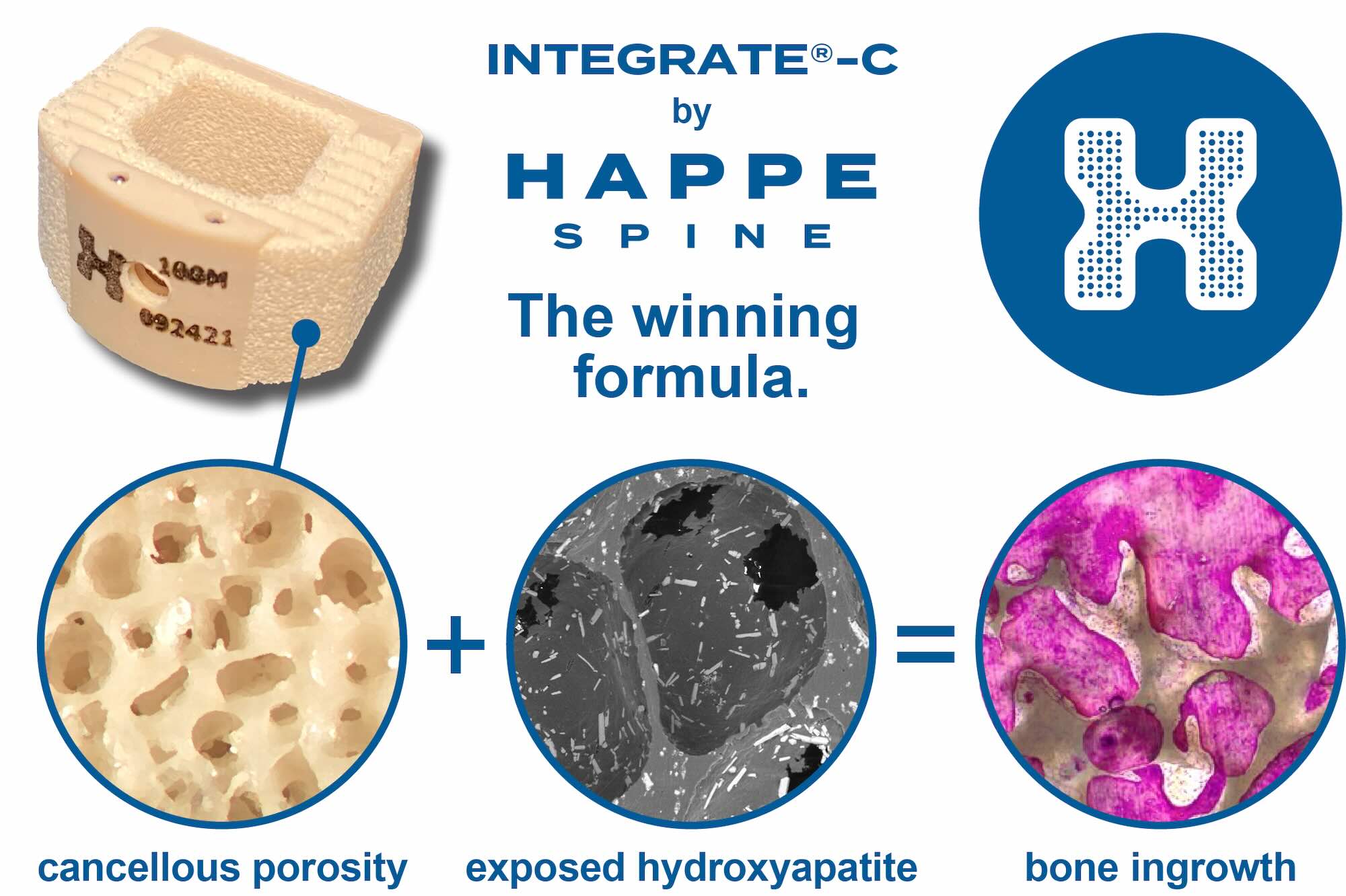Bonezone Backbones Of Innovation Signal Whats Next In Spine Care